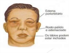 Facies – Medicina Cardiometabólica