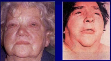 Facies – Medicina Cardiometabólica