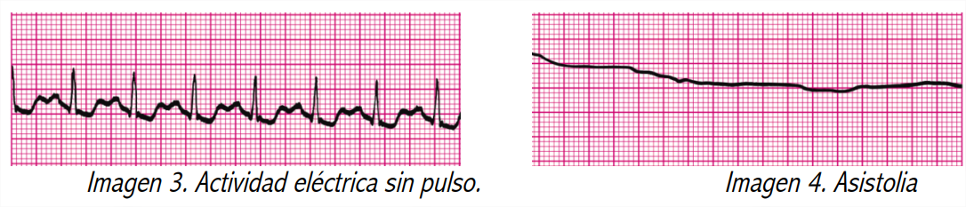 IDENTIFICACIÓN Y MANEJO DE ARRITMIAS – Medicina Cardiometabólica