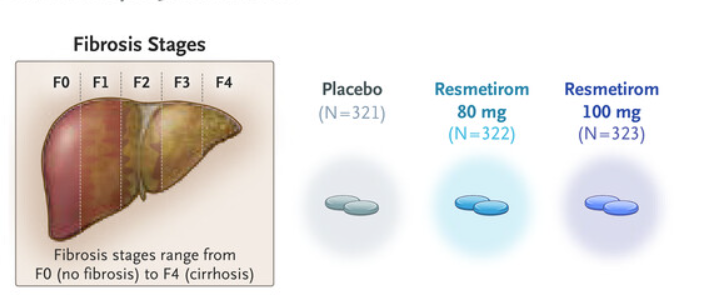 PRIMER FARMACO PARA TRATAR HIGADO GRASO – Medicina Cardiometabólica